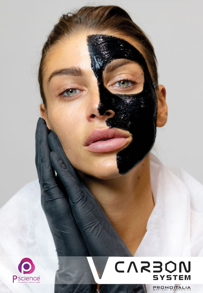 V Carbon System - Pscience